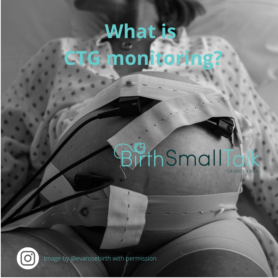 What is CTG monitoring? – Birth Small Talk