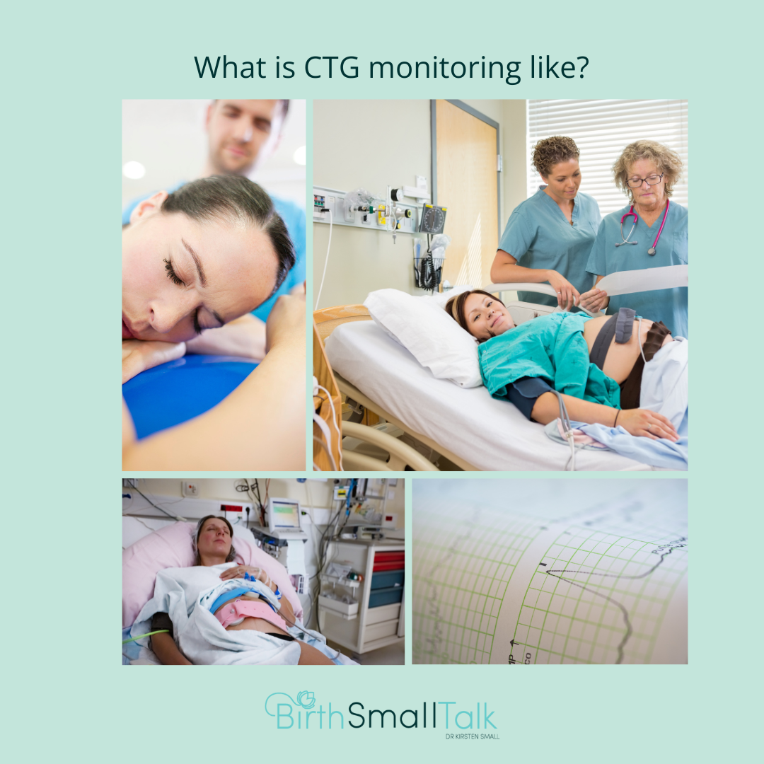 What is CTG monitoring like? – Birth Small Talk