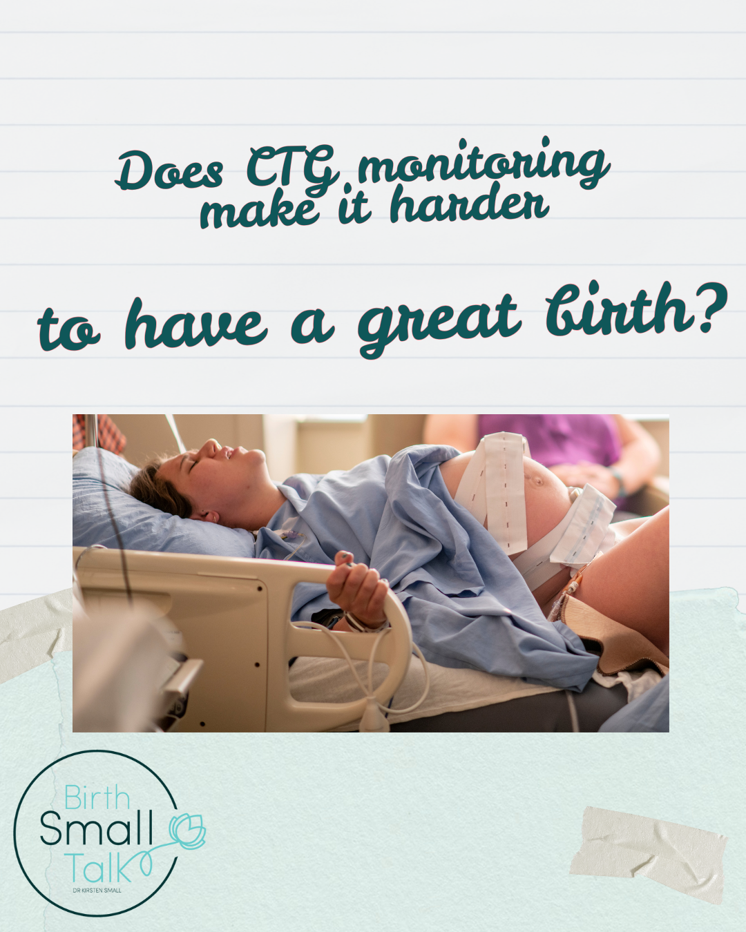 Does CTG monitoring make it harder to have a great birth? – Birth Small ...